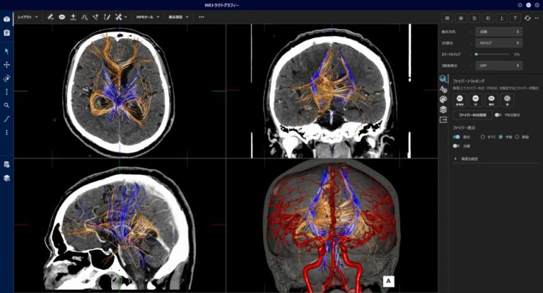アプリケーション（頭部領域） | REVORAS