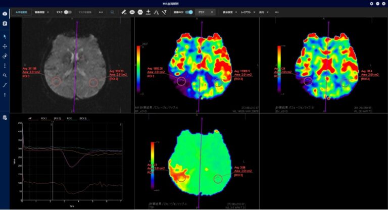 アプリケーション（頭部領域） | REVORAS