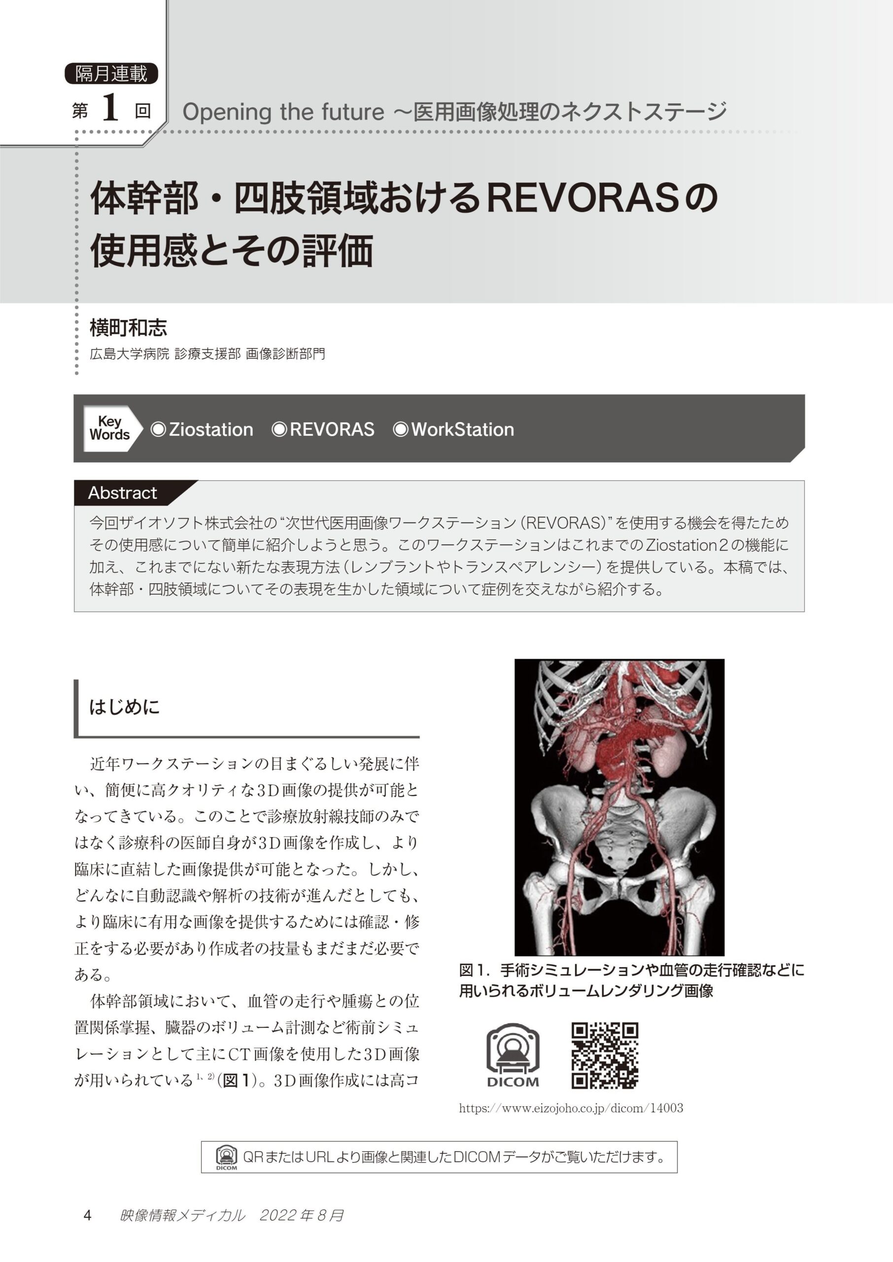 体幹部・四肢領域におけるREVORASの使用感とその評価｜事例紹介 | REVORAS