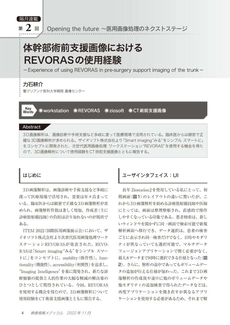 体幹部術前支援画像におけるREVORASの使用経験｜事例紹介 | REVORAS