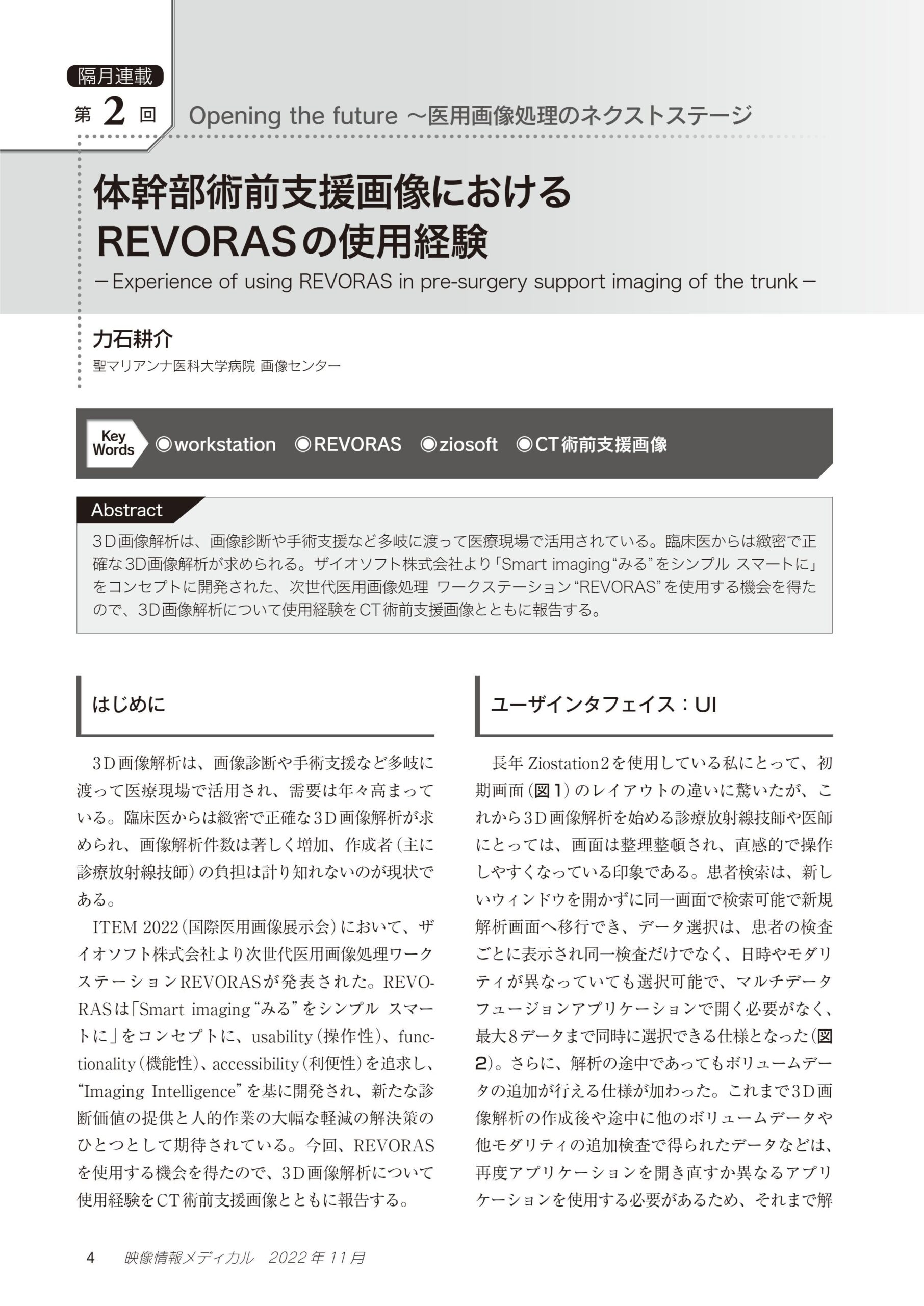 体幹部術前支援画像におけるREVORASの使用経験｜事例紹介 | REVORAS
