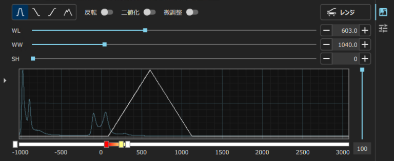 ウィンドウ幅（WW）｜医用画像用語集 | REVORAS